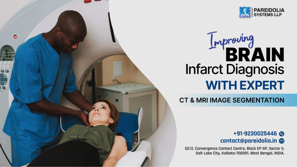 Pareidolia » Blog Archive Brain Infarct Diagnosis: Expert CT & MRI ...