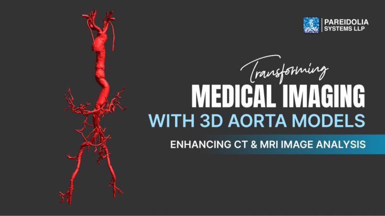 Pareidolia » Blog Archive 3D Aorta Models for Advanced CT & MRI ...