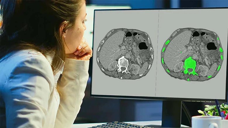 The Ultimate 2026 Guide to Medical Image Annotation & Segmentation Services - Pareidolia Systems